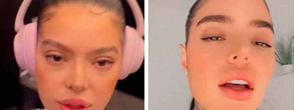 ¿Quién dijo que me opero porque soy fea? Así quedó Melissa Gate tras ...