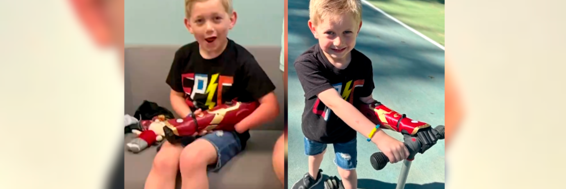 EN VIDEO: Brazo de ‘Iron Man’ cambió la vida de un niño: es la ...