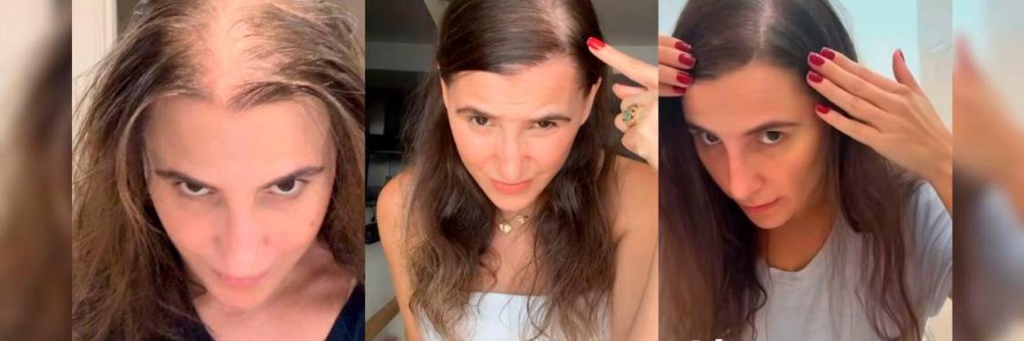 El hair oiling, la técnica con la que Marcela García recuperó su pelo